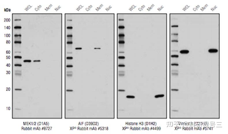 实验室祖传！Western Blot 实验全流程步骤+常见问题解决方案！ - 知乎