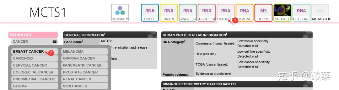 仙桃学术 | 仙桃风单基因乳腺癌MCTS1 - 知乎