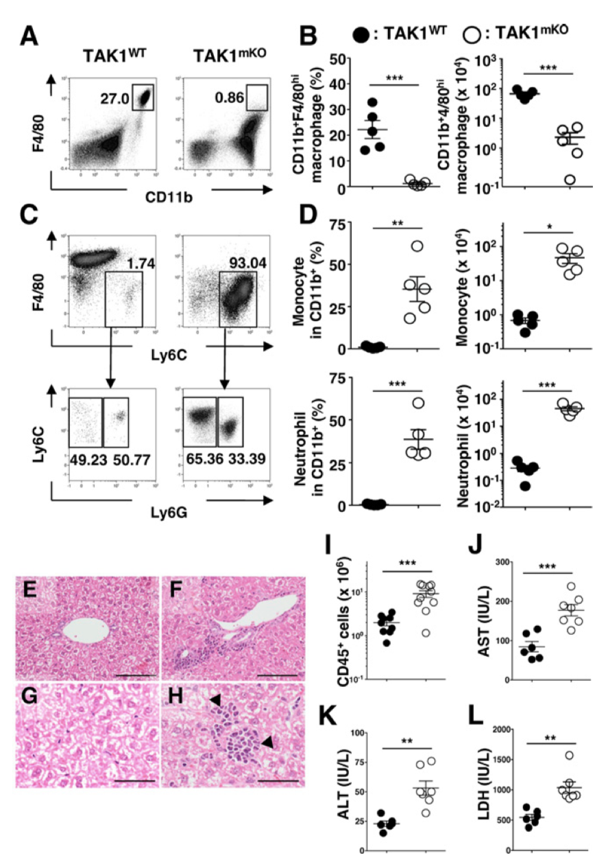 J Immunol丨TAK1 限制死亡受体 Fas 诱导的巨噬细胞死亡 - 知乎