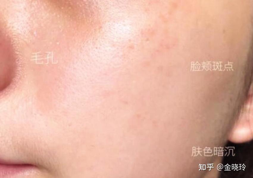天生黑黄皮怎么变白？