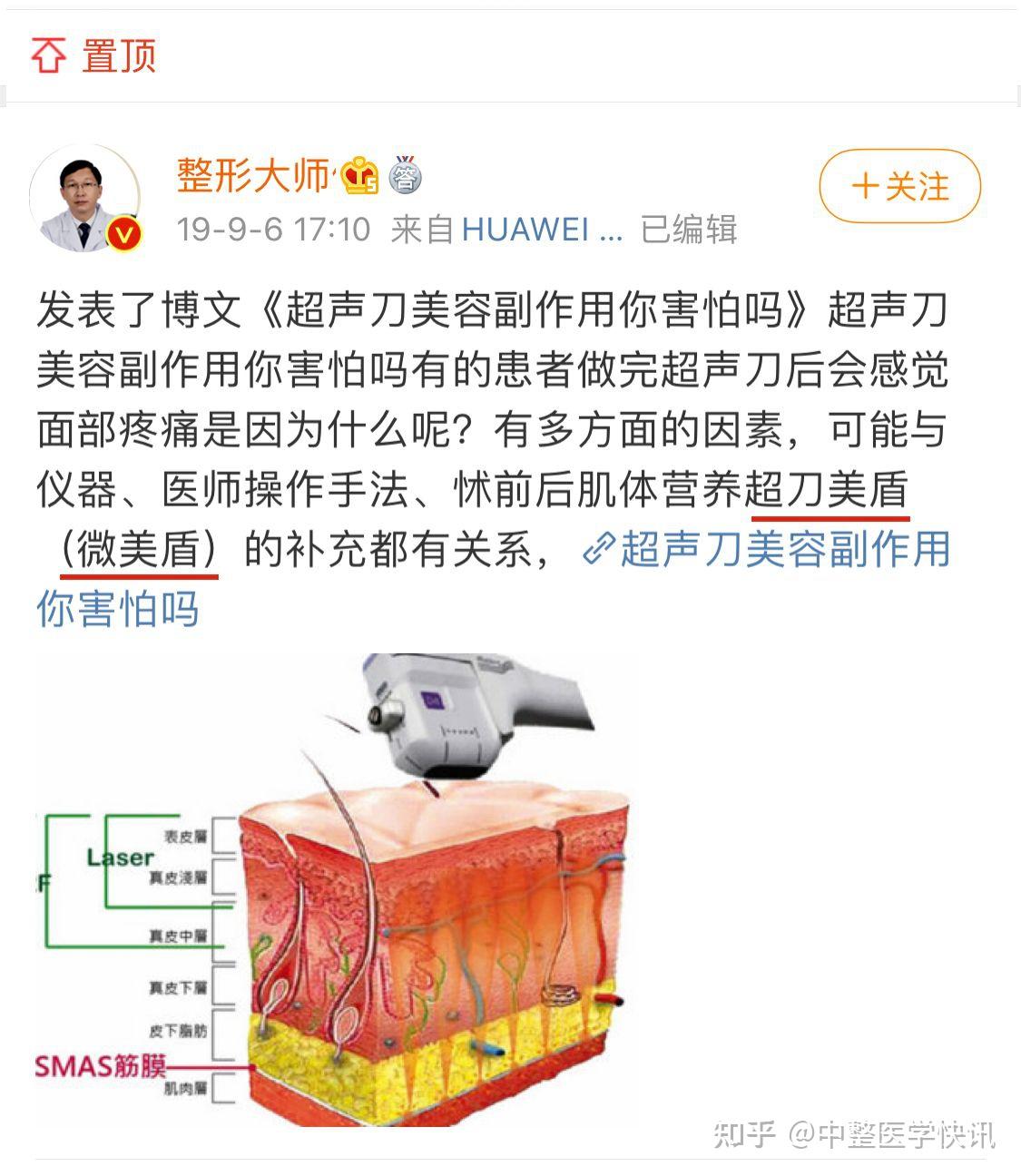 科普:超声炮和超声刀的区别?哪个好?有何不同处? 知乎
