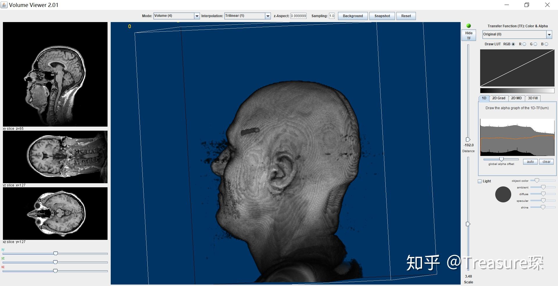 ImageJ实用技巧——3D可视化及测量(定量分析篇) - 知乎