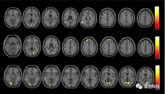 Nature子刊 | 你知我意：精神病人的威胁性评估的fMRI标志物 - 知乎
