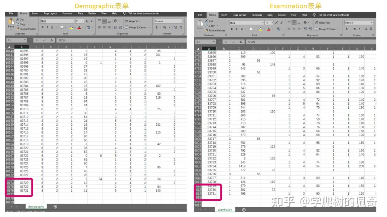 NHANES数据库练手DAY13(骨质疏松的危险因素) - 知乎