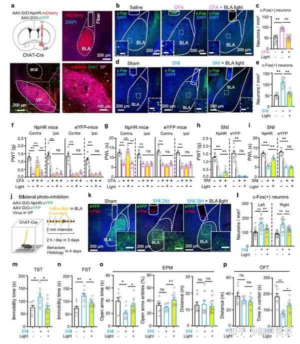 腹侧苍白球胆碱能环路调控慢性疼痛相关焦虑和抑郁情绪的神经环路机制 - 知乎