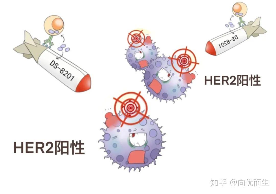 肿瘤细胞的死对头“DS-8201”，对疾病控制率高达72%！ - 知乎
