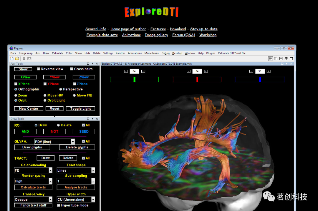 磁共振弥散成像(dMRI)分析方法 - 知乎