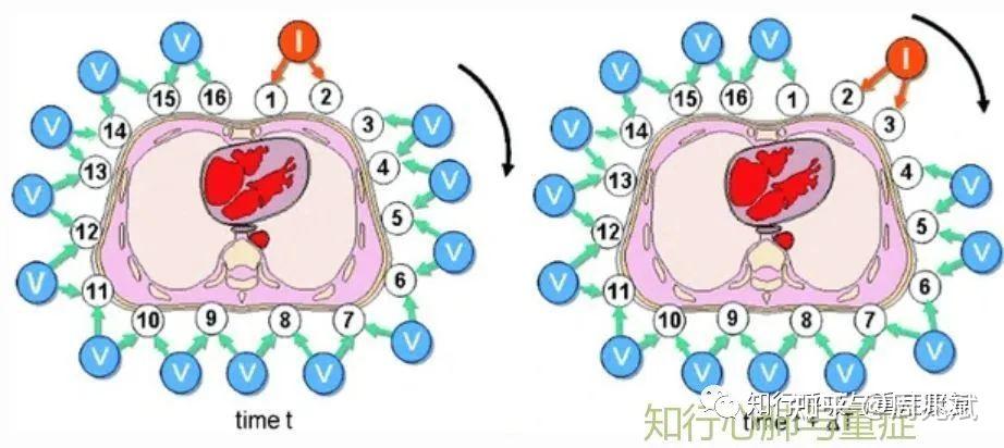 第139期胸部电阻抗断层成像（EIT）的原理、图像分析及临床应用 - 知乎