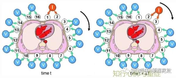 第139期胸部电阻抗断层成像（EIT）的原理、图像分析及临床应用 - 知乎