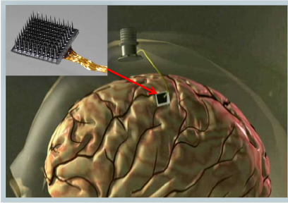 神经信号记录电极简介 - 知乎