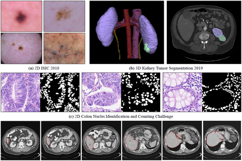 医学影像分割tricks合集：Deep Learning for Medical Image Segmentation:Tricks ...