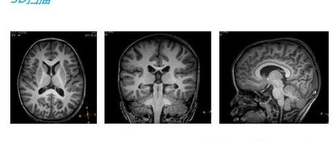 DTI技术原理及临床应用 - 知乎