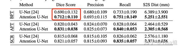 三行命令搞定nnUNet v2训练及推理！（三） - 知乎