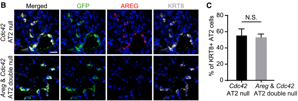 240919 文献精读Plus Cell Stem Cell AREG+肺纤维化 - 知乎