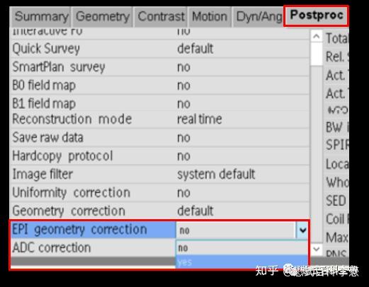 消除EPI几何形变技术——EPIC - 知乎