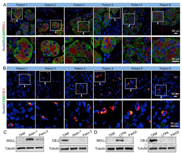 还原响应型RNAi纳米平台重组肿瘤脂质代谢和复极化巨噬细胞用于胰腺癌联合治疗 - 知乎
