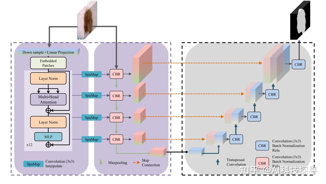UNet+注意力机制双结合速度狂提98.82％！起步发一区！ - 知乎