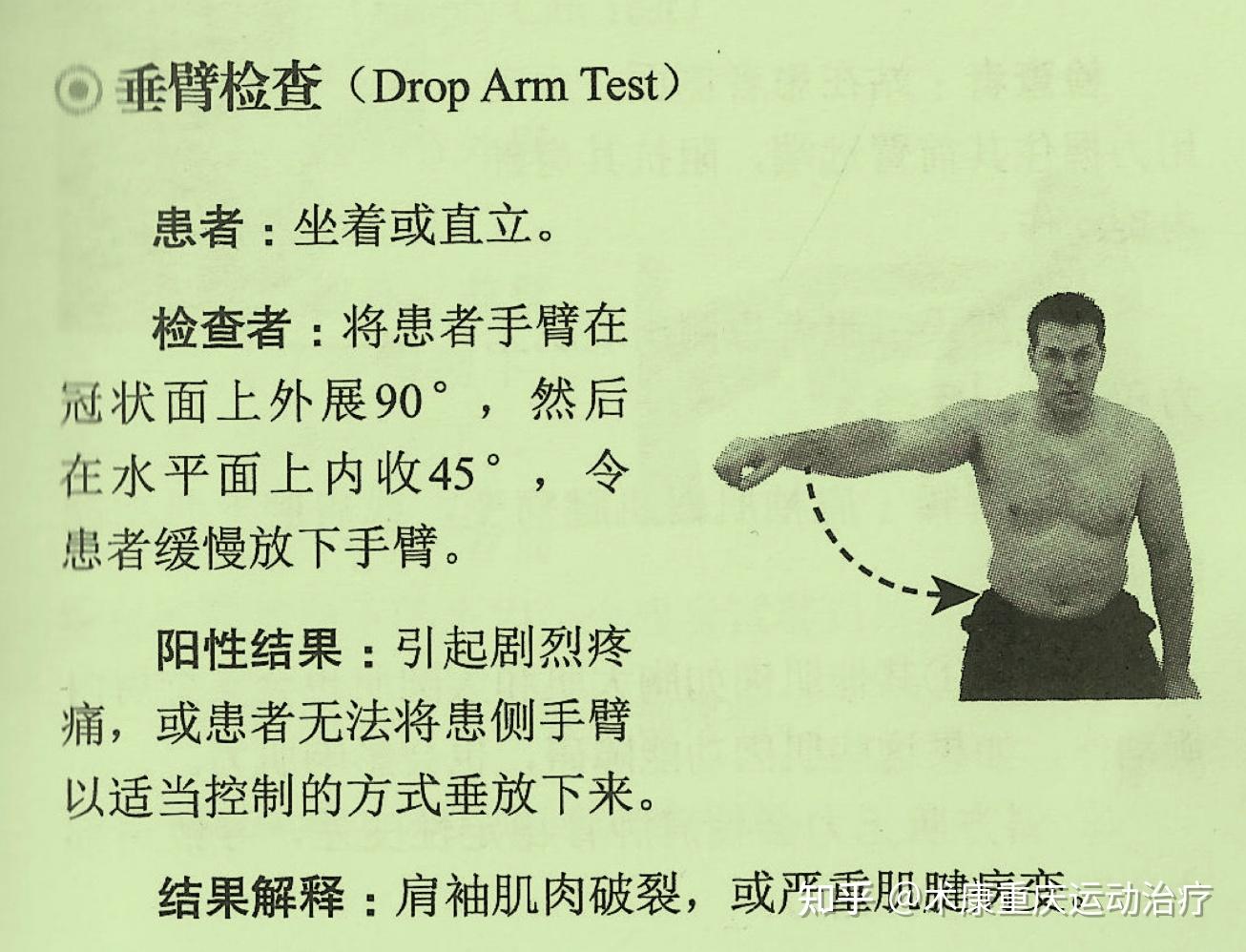 肩运动损伤｜肩峰撞击 - 知乎