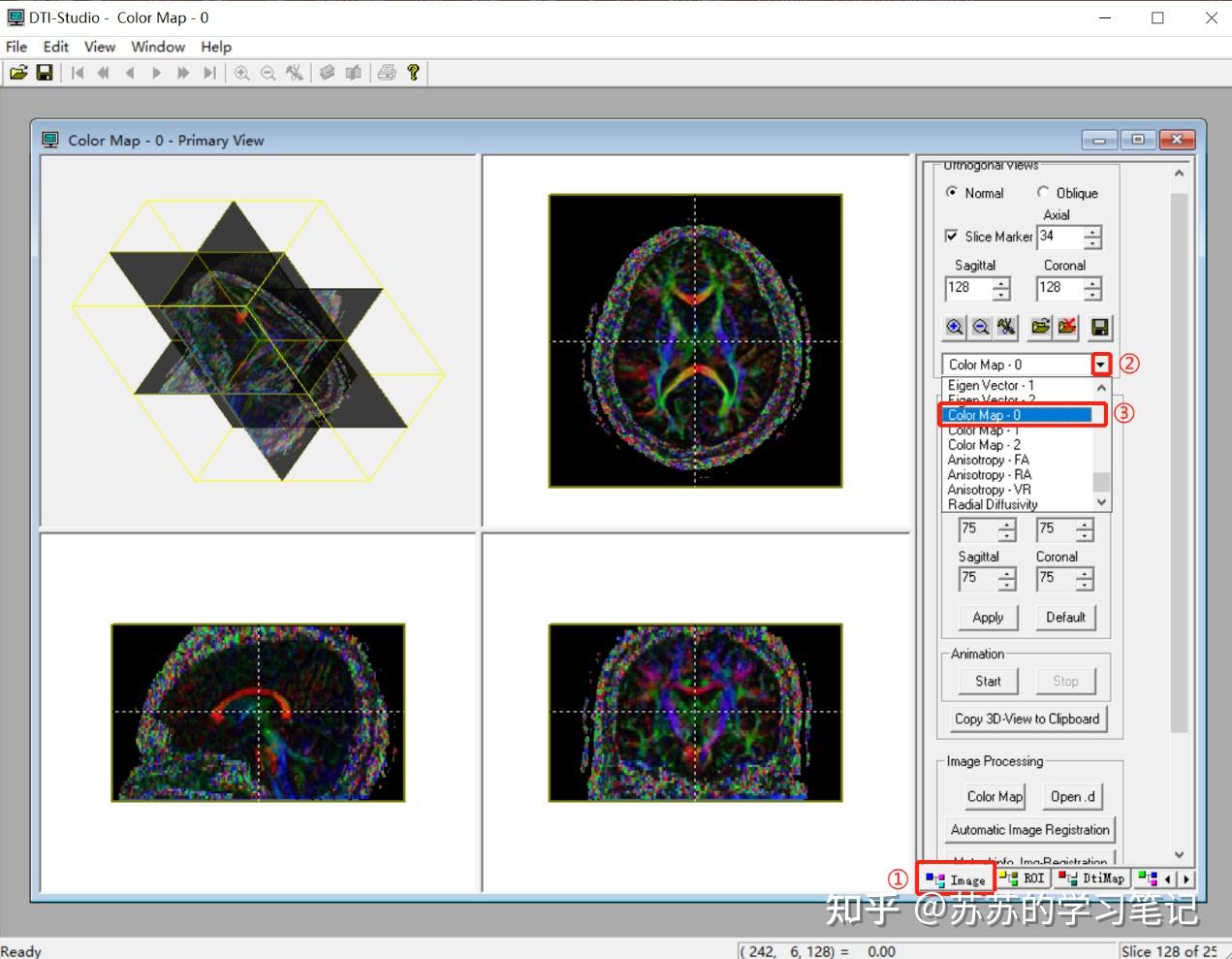 DTI Studio操作教程 - 知乎