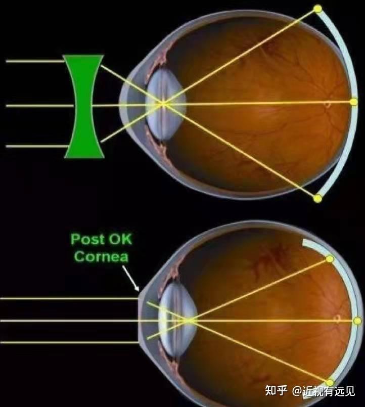 OK镜到底OK不OK？ - 知乎