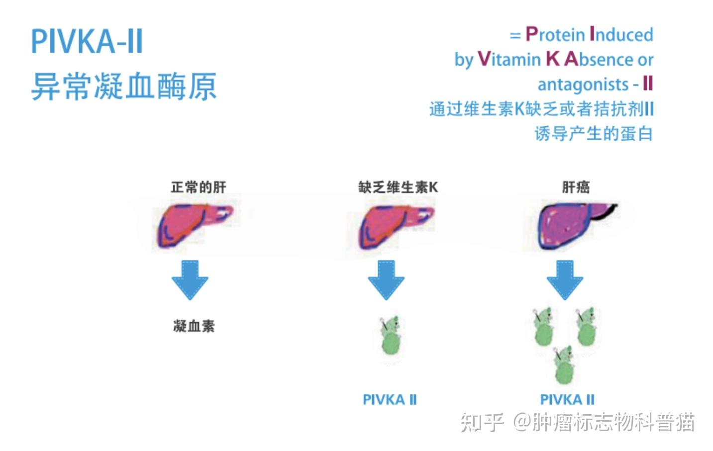 肿瘤标志物科普系列--异常凝血酶原（PIVKA-II）升高原因分析 - 知乎