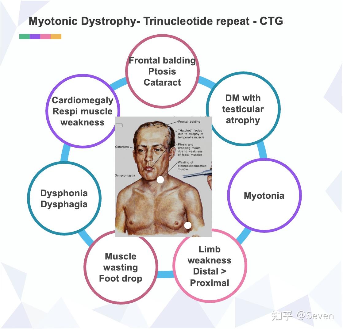 医学思维导图-神经内科-myotonic dystrophy 的临床表现? - 知乎