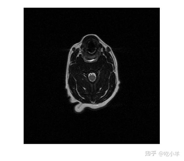 Matlab图像处理：114：创建包含 Dicom 图像的图像数据存储 知乎 