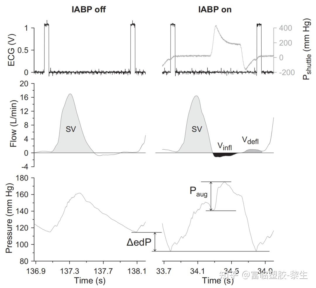 新形状的 IAB 可使半卧位患者的 IABP 治疗更加有效 - 知乎