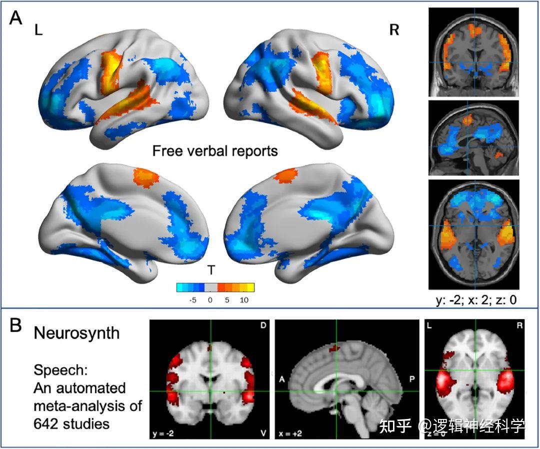 NeuroImage︱中国科学院心理研究所严超赣团队开发Think-Aloud fMRI研究范式并刻画静息态自发思维的大脑表征模式 - 知乎