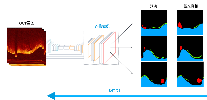 CCEC·前沿技术｜当人工智能“预见”OCT - 知乎