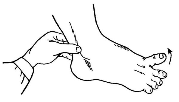 巴宾斯基（Babinski）征怎么查 - 知乎