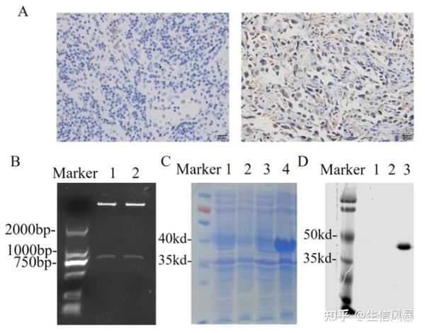 Nature：新的CD30 CAR-T细胞可能是治疗癌症的候选药物 - 知乎