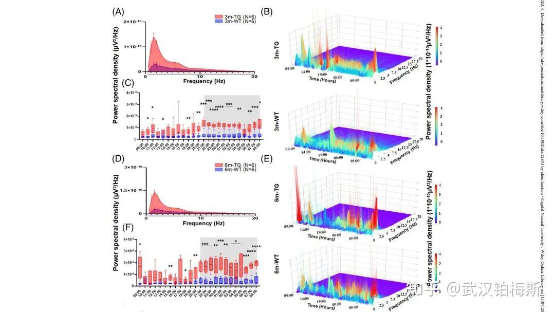 EEG实验场景大盘点：睡眠、癫痫等研究全覆盖——大小鼠在体脑电监测 - 知乎
