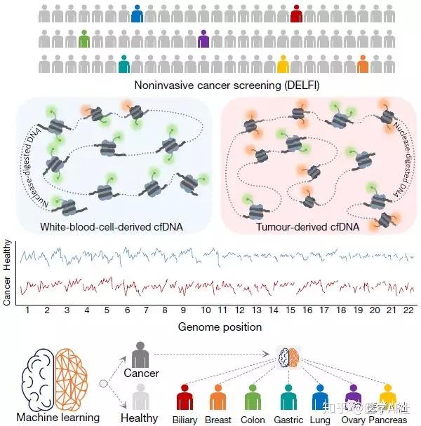 Nature 丨 机器学习结合cf-DNA液体活检助力癌症早期诊断 - 知乎