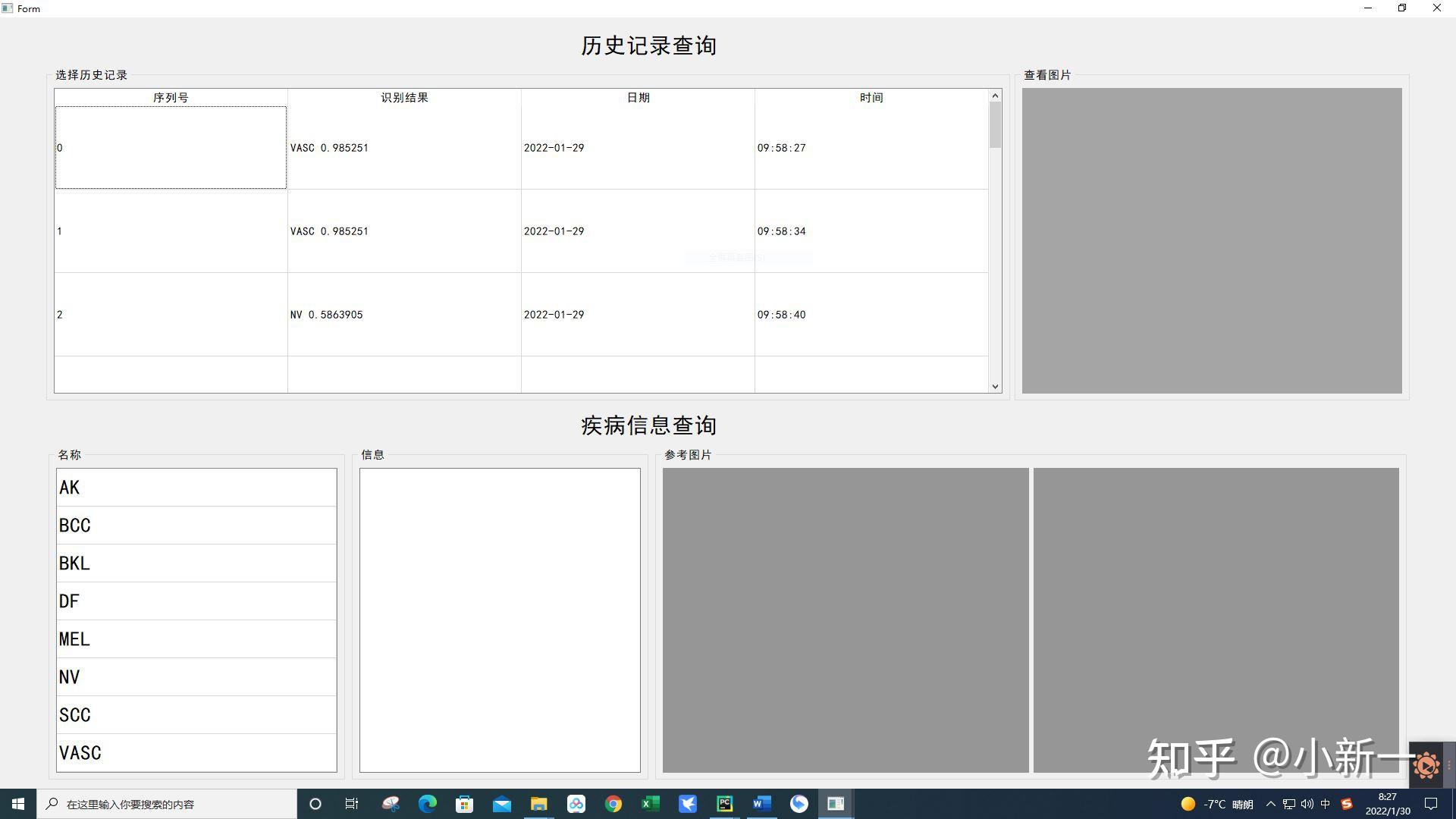 皮肤病识别系统项目，使用pyqt5进行界面的搭建。 知乎 