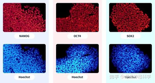 iPSC+基因编辑，助力神经系统疾病研究 - 知乎