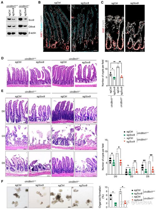 EMBO J | 新发现！circRNA可以调控肠道干细胞的自我更新 - 知乎