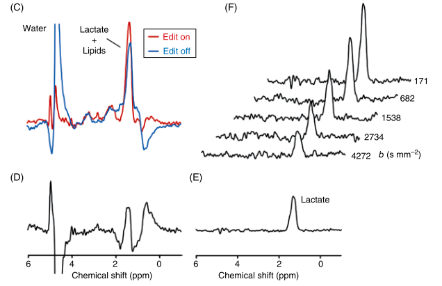 多量子滤波原理初探（Multiple Quantum Coherence Editing ） - 知乎