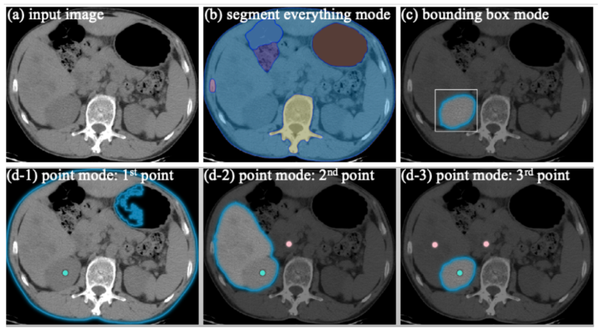 通用AI大型模型Segment Anything在医学图像分割领域的最新成果！ - CV技术指南（公众号） - 博客园