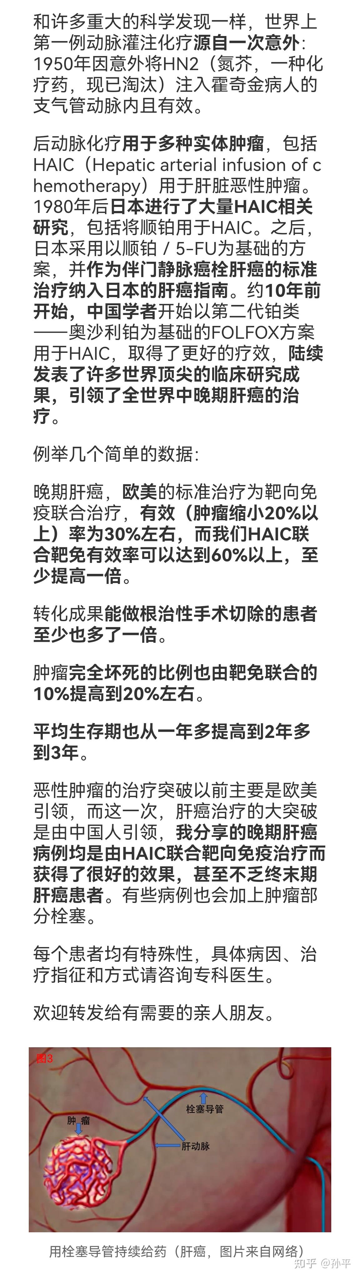 75、浅谈肝动脉灌注化疗（HAIC）的前世今生 - 知乎