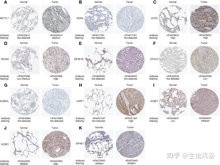 千万不能错过的生信热点！6+m7G预后模型的生信思路！ - 知乎
