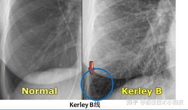 心脏的影像知识（2） - 知乎