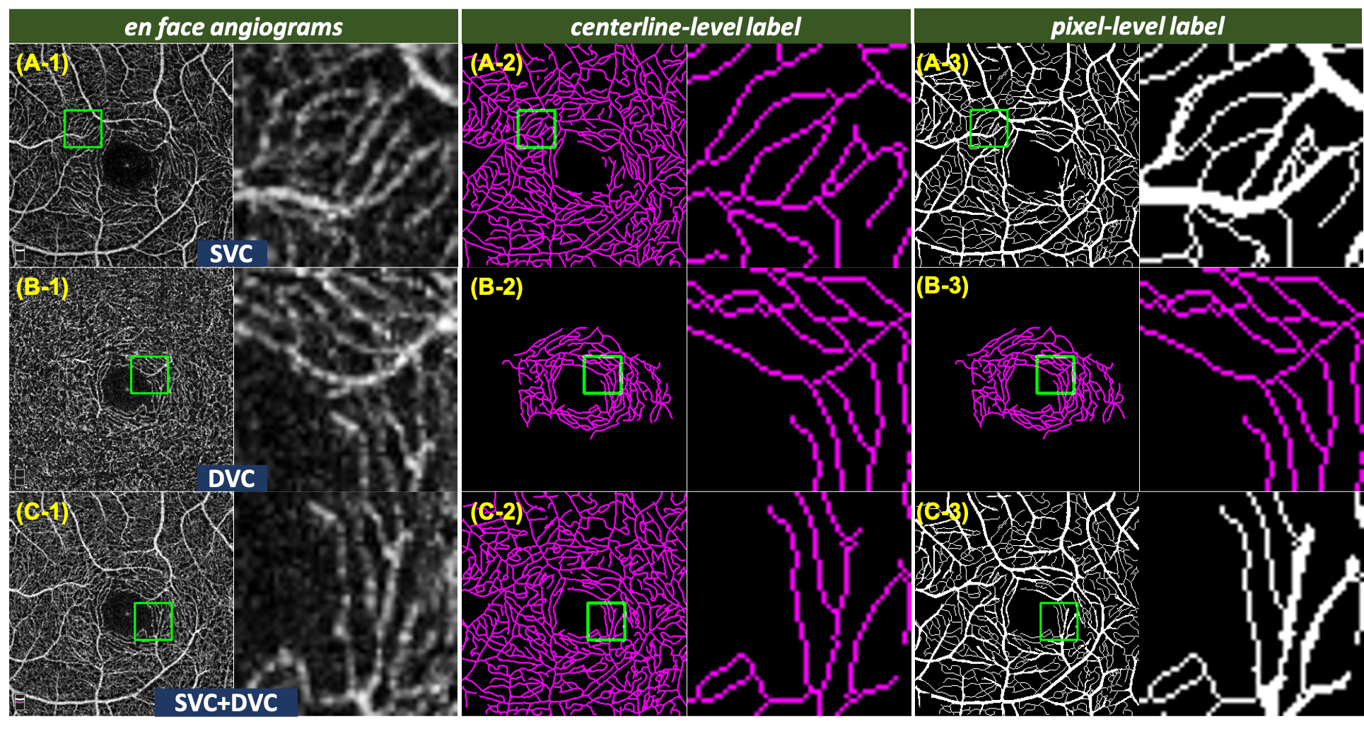 ROSE 数据集介绍 - 知乎