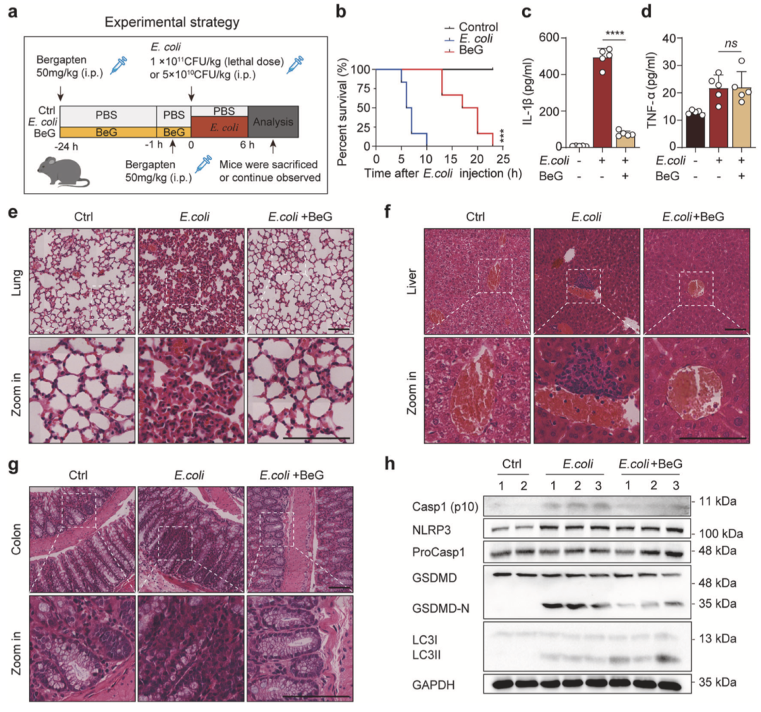 药理学报丨Bergapten 通过促进线粒体自噬抑制 NLRP3 炎症小体激活和细胞焦亡 - 知乎