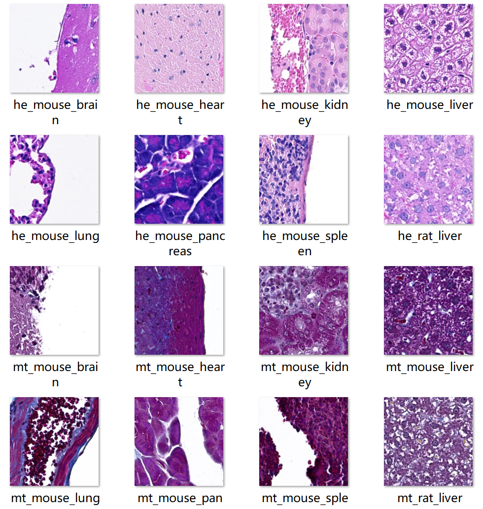 NAFLD 数据集介绍 - 知乎
