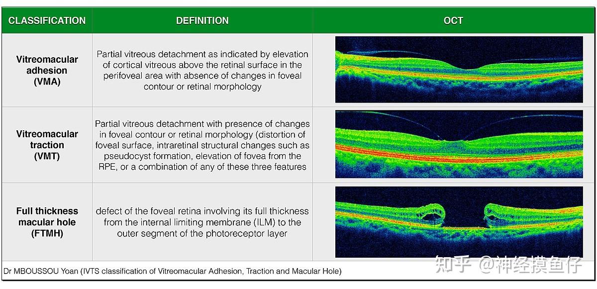 Chen et al. (2019) Retinal OCT Image Analysis 学习笔记 - 知乎