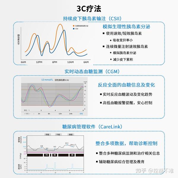 美敦力722胰岛素泵闭环系统，3C疗法 - 知乎