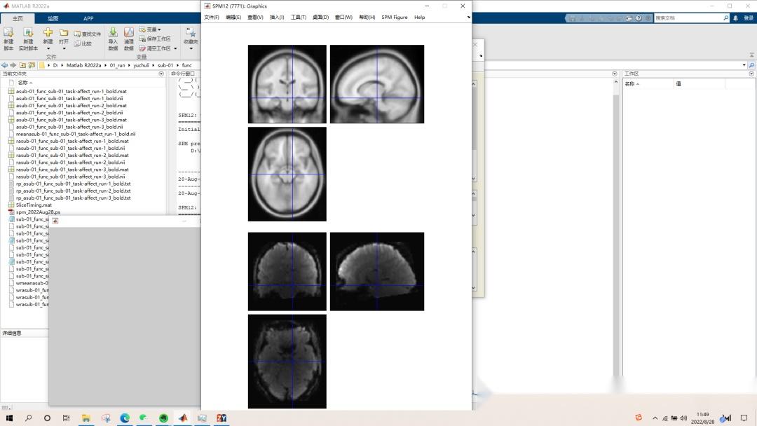 如何用SPM完成fMRI数据的预处理【任务态】 - 知乎