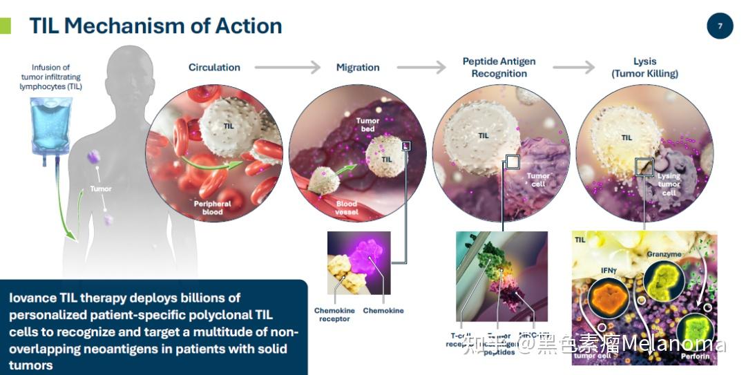 神奇的史蒂夫（TIL疗法的前世今生） - 知乎