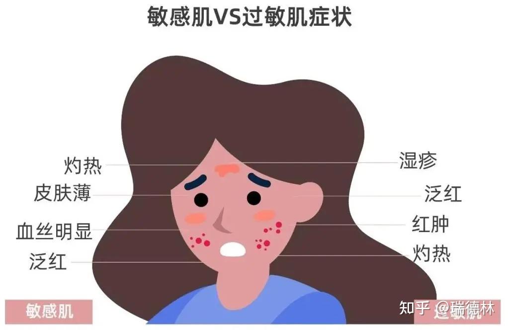 健康百科丨nonono!春敏≠过敏! 知乎